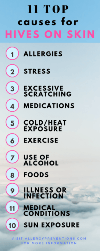 11 Top Causes for Hives on Skin - Allergy Preventions