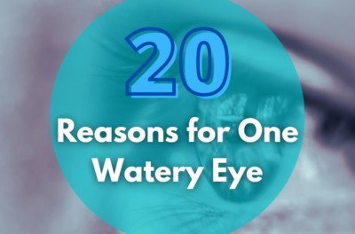 20 Reasons for One Watery Eye - Allergy Preventions