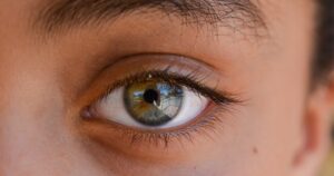 15 Reasons for One Watery Eye - Allergy Preventions